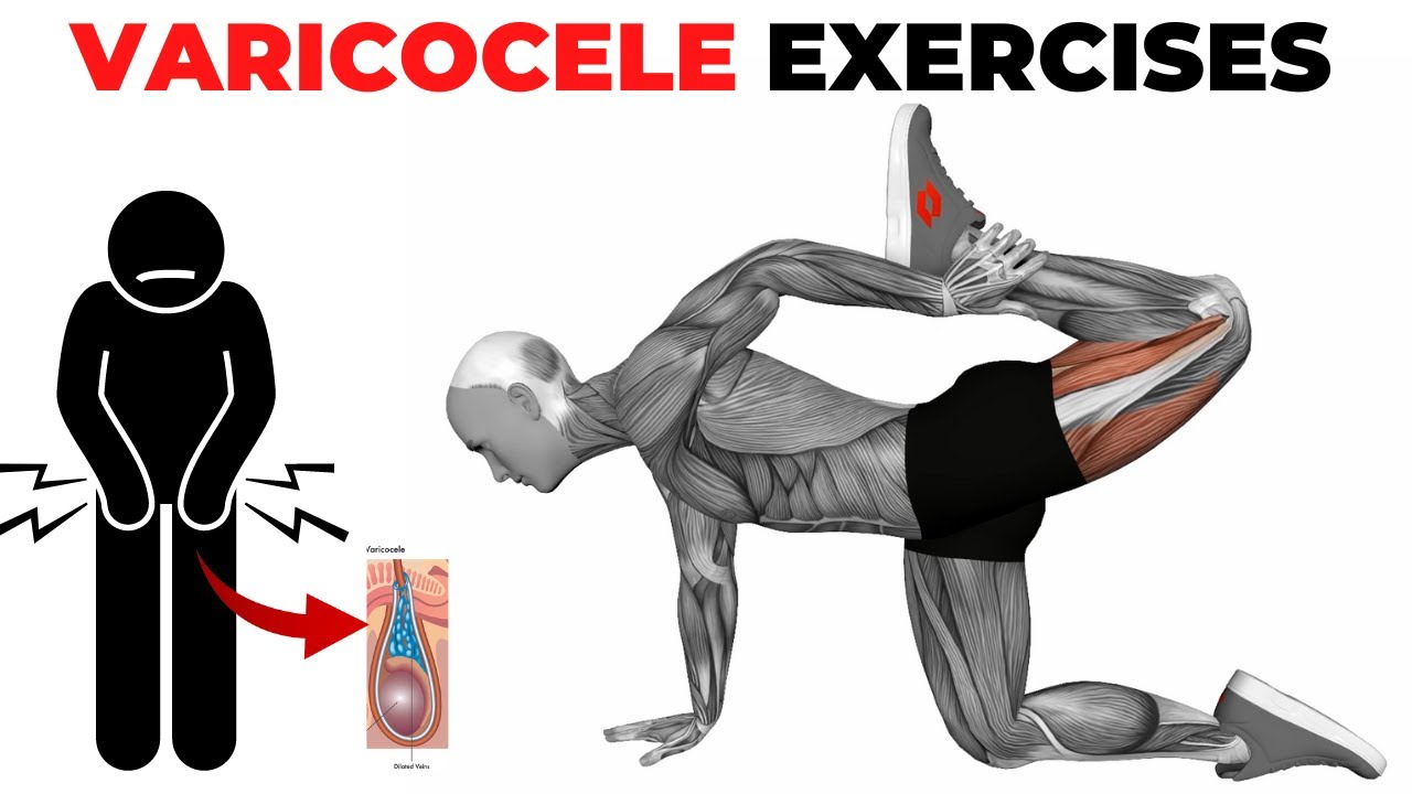 Pelvic Floor Exercises to Treat Varicocele - YouTube