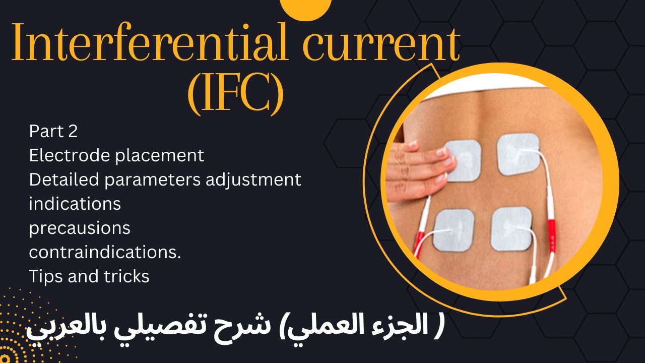 الجزء العملي الخاص ب Interferential current (IFC/IFT) - YouTube