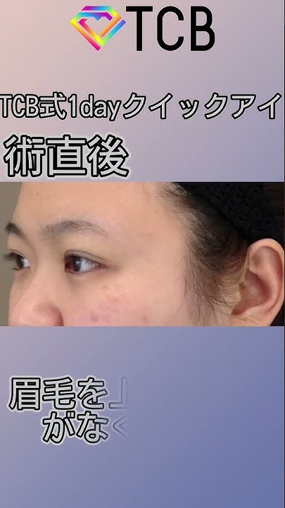 【TCB式1dayクイックアイ】一重から優しい目元に！💕#shorts - YouTube