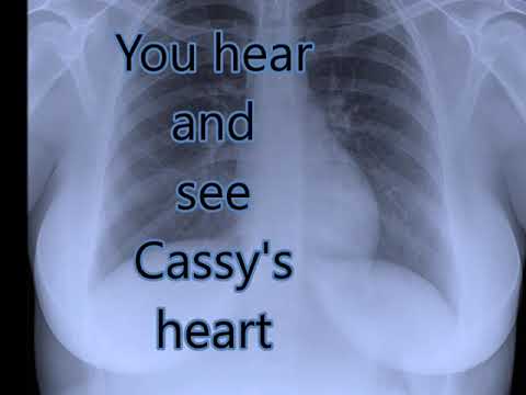 Each Person's Heartbeat is as Unique as a Fingerprint