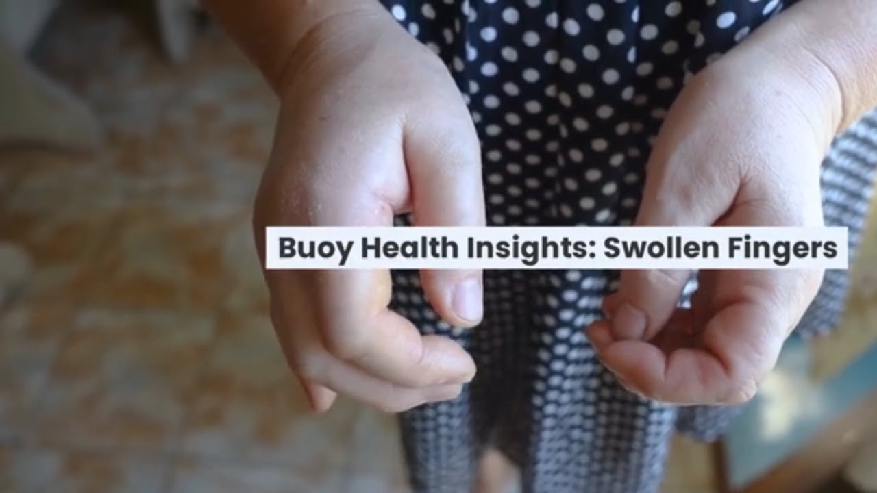 Swollen Fingers: Common Causes and When to Seek Medical Care ...