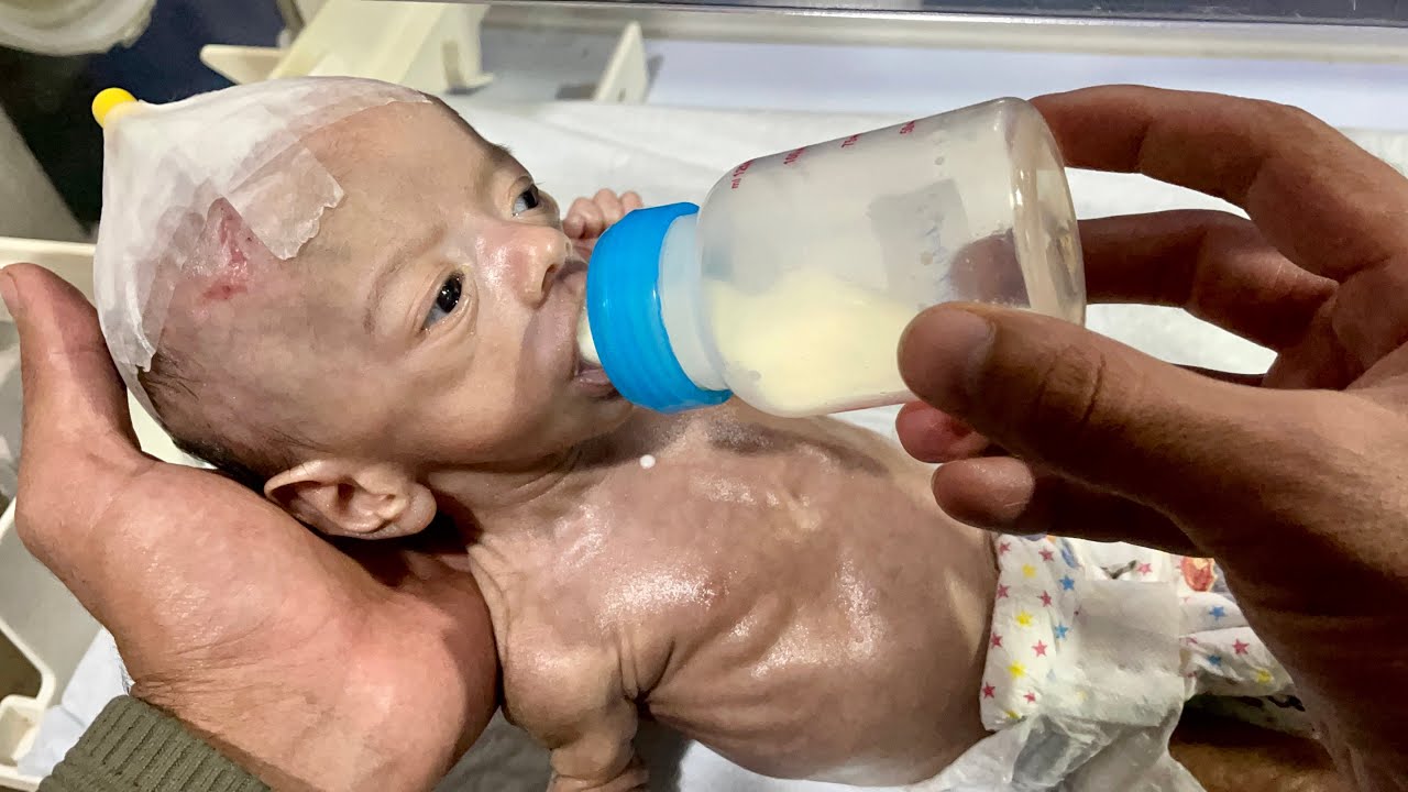 Giving feeding to a cute adorable little baby in NICU🍼🧑‍🍼🥰 #newbornbaby ...