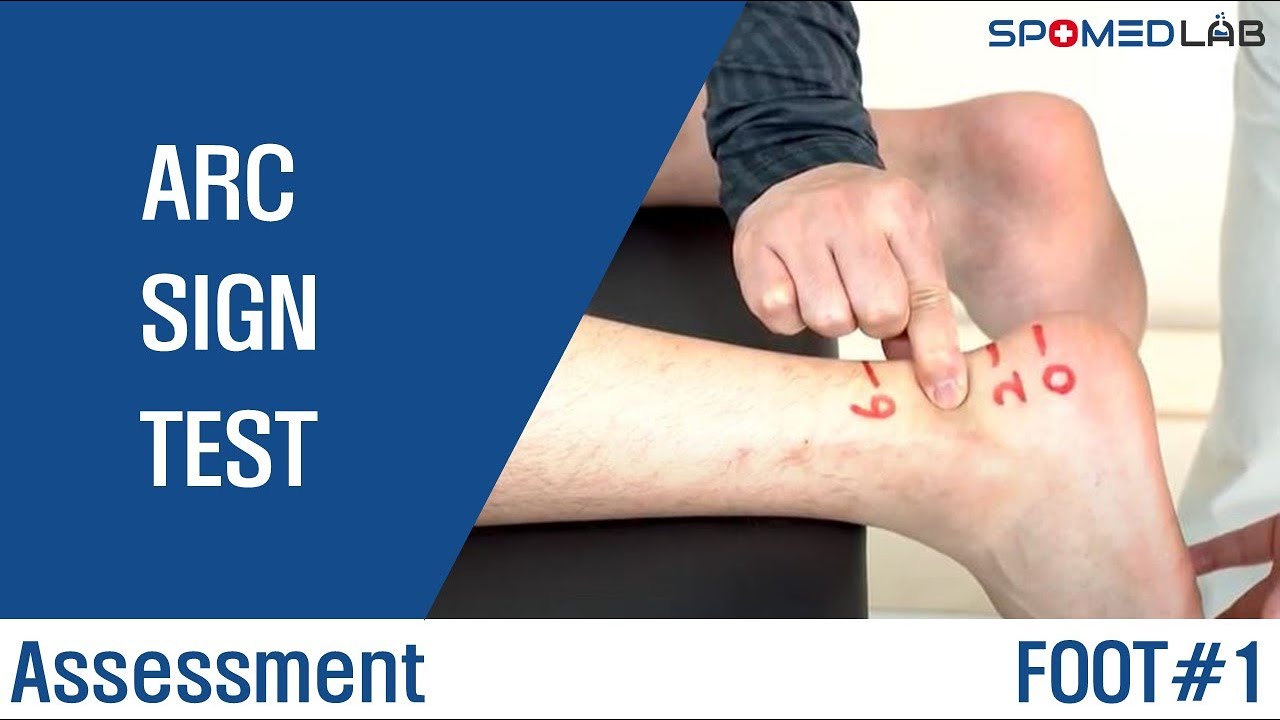 Arc Sign Test I 아킬레스건병증 평가 I foot#1 - YouTube