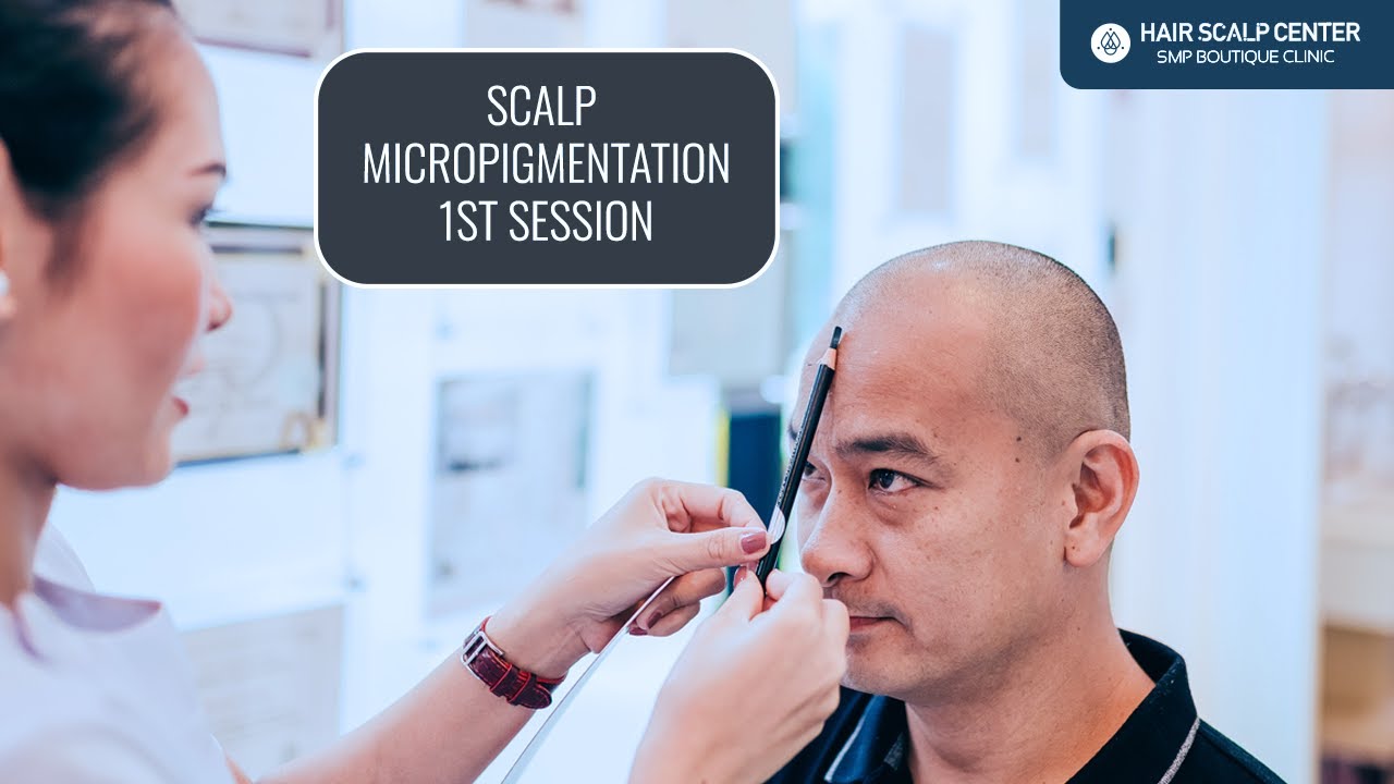 Watch Shane's first scalp micropigmentation (SMP) session at Hair Scalp ...