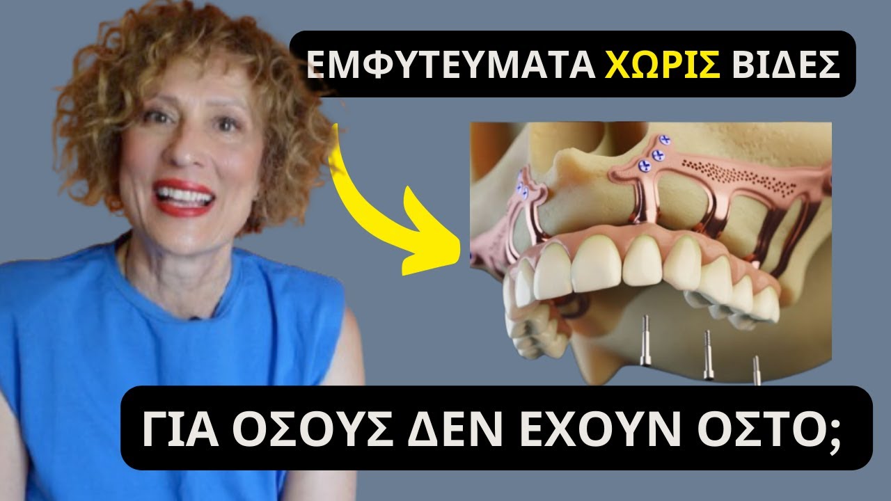 Εμφυτεύματα χωρίς βίδες; Μύθος ή πραγματικότητα; - YouTube