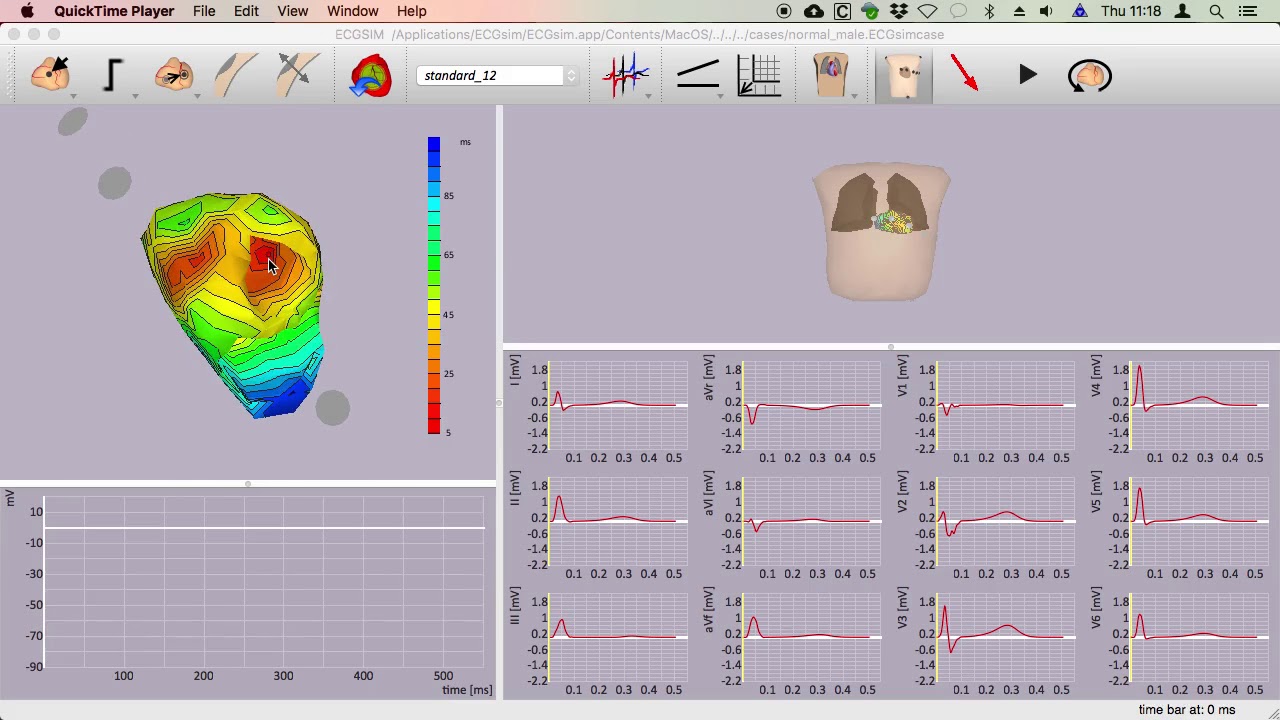 Basic usage of ECGsim - YouTube