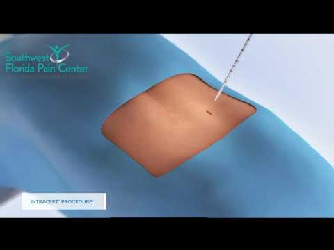 The Intracept® Procedure - YouTube