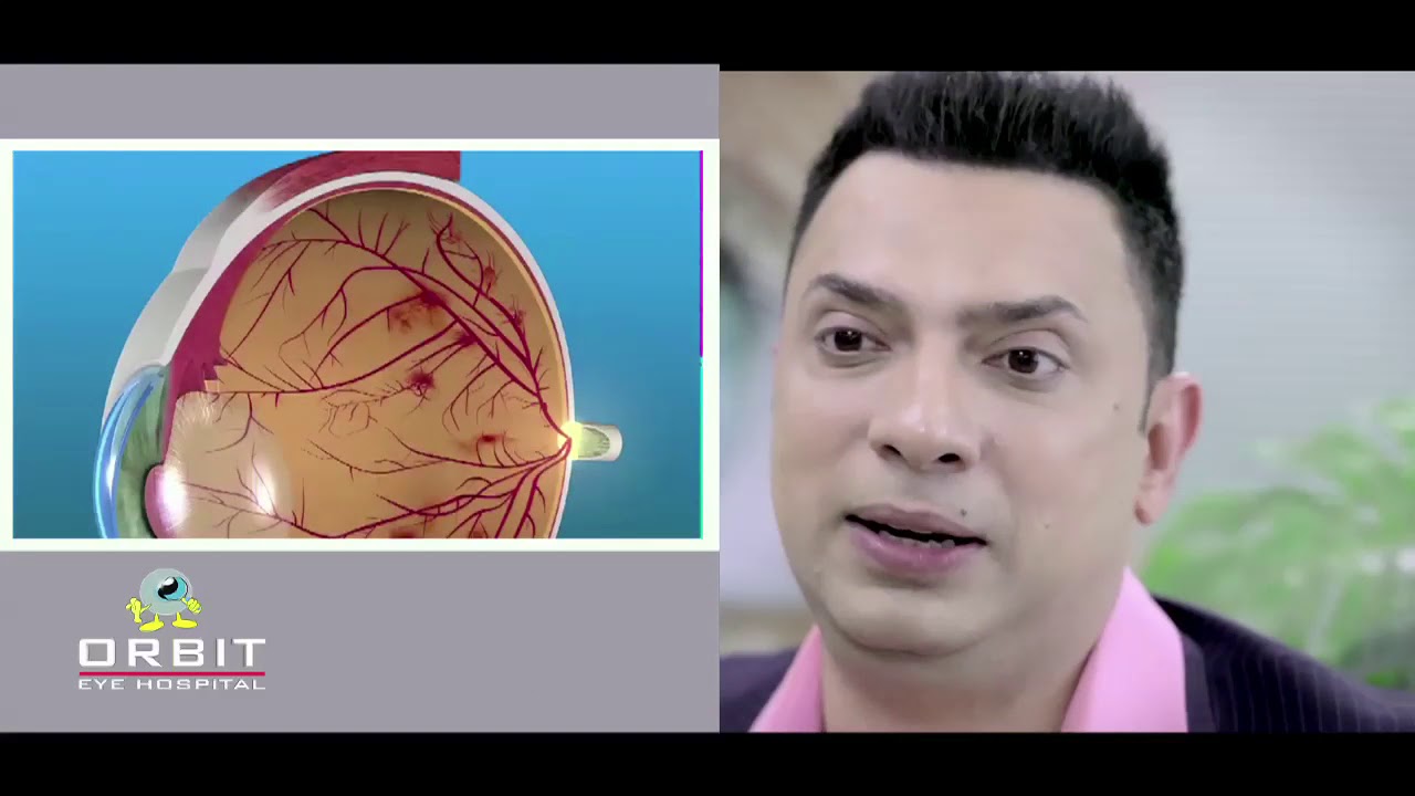 Orbit Eye Hospital - YouTube