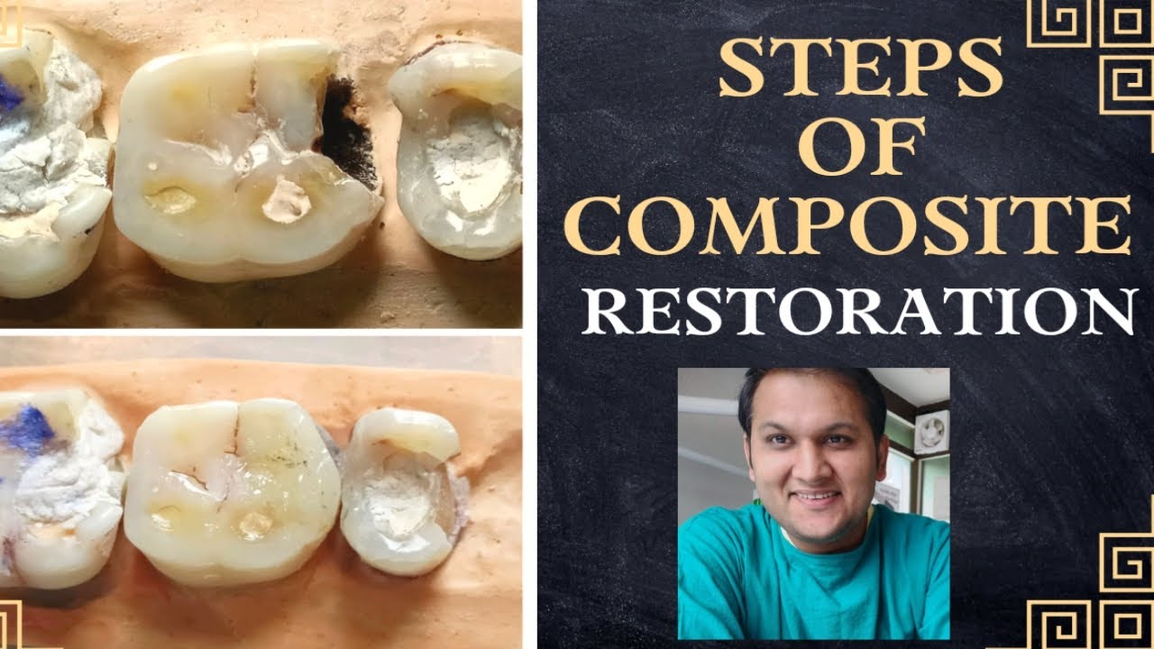 Steps Of Composite Restoration YouTube steps-of-composite-restoration-youtube