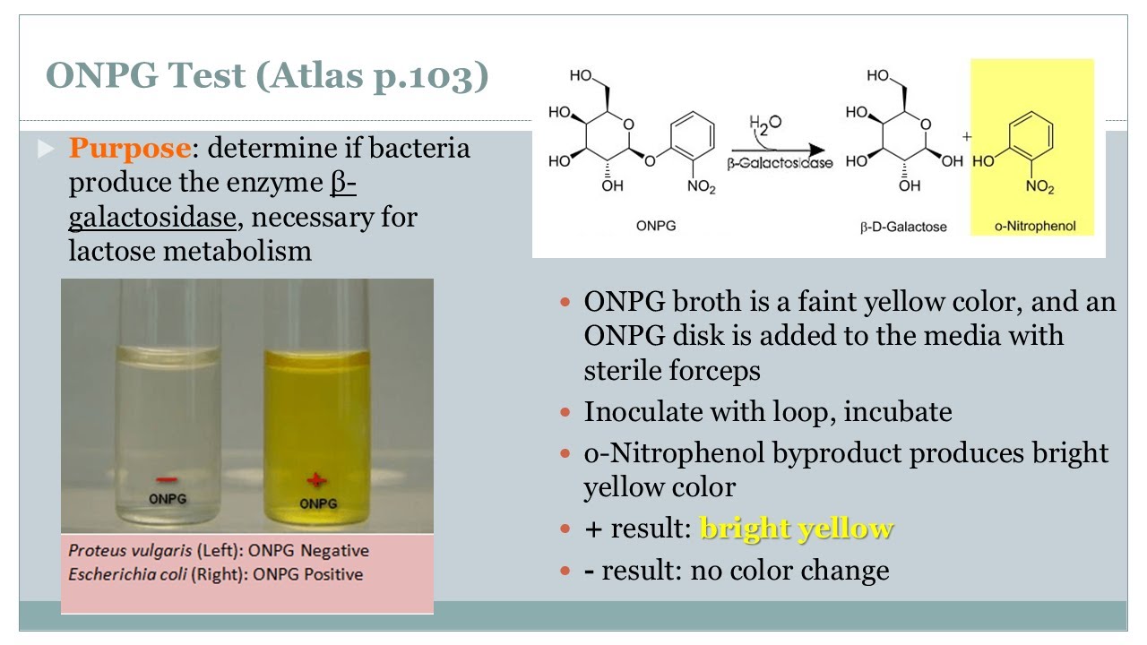 ONPG Test - Microbiology Class - Podcast (CC) - YouTube