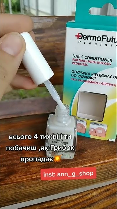 Засіб проти грибка нігтів /грибок нігтів - YouTube