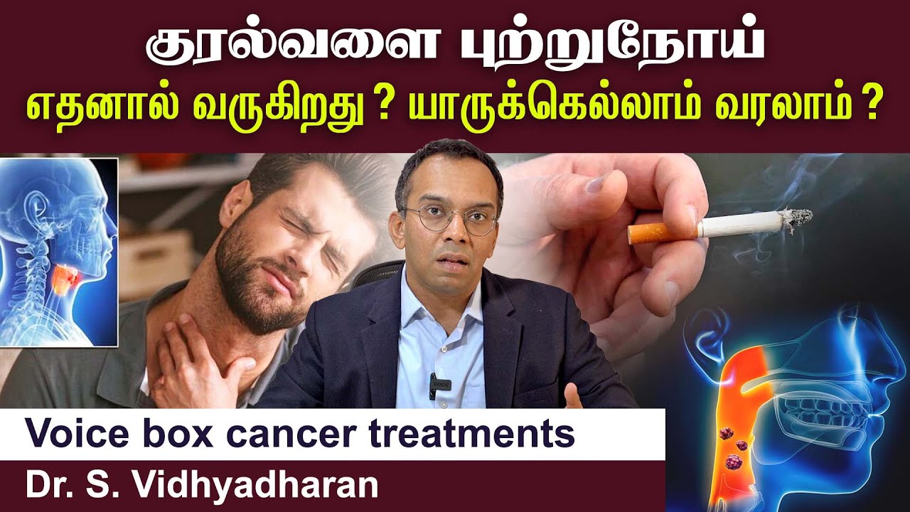 குரல்வளை புற்றுநோய் வர காரணம் | Voice box cancer | Poongaatru - YouTube