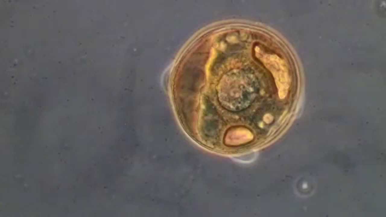 Arcella sp.- - YouTube