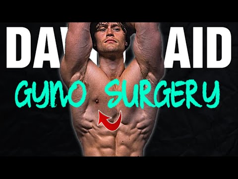 David Laid Exposes Gyno Surgery