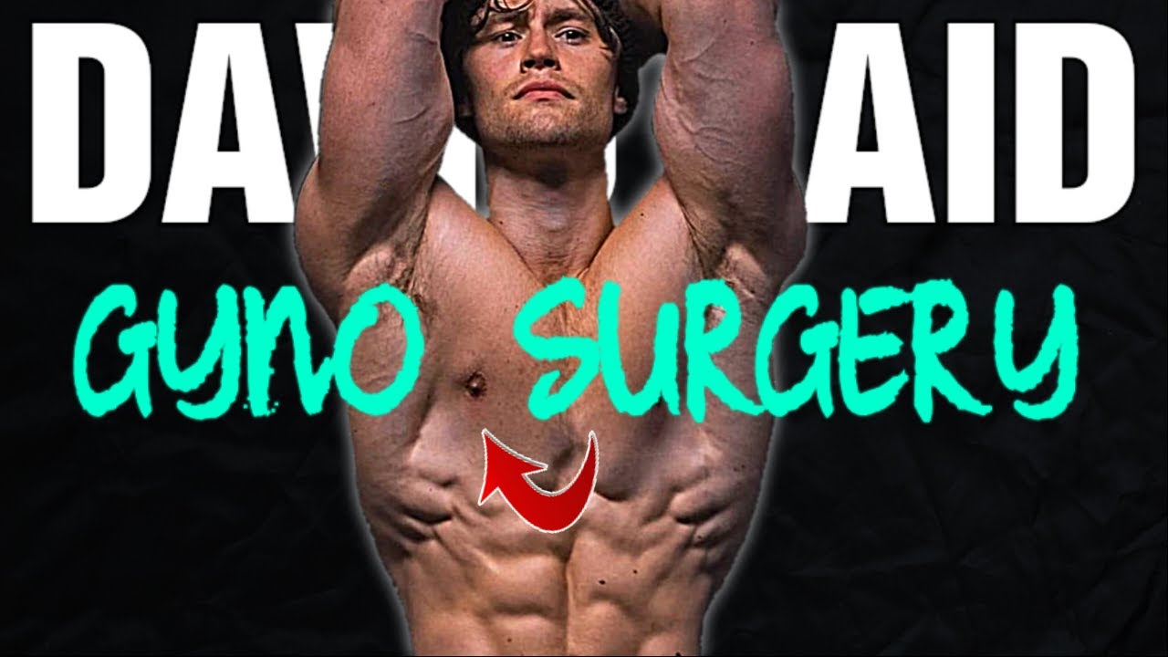 David Laid Exposes Gyno Surgery - YouTube