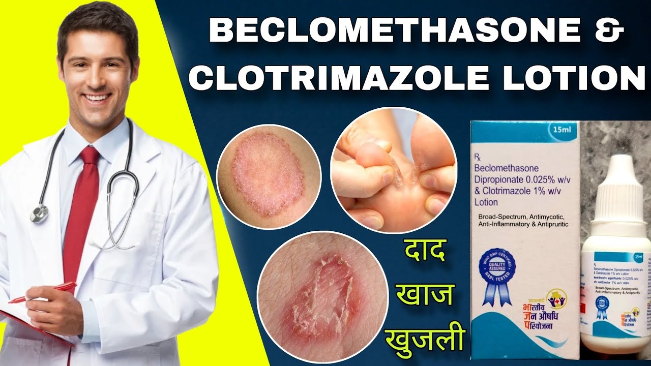 Ringworm Fungal Infection फंगल इंफेक्शन के लिए रामबाण Antifungal Lotion Youtube