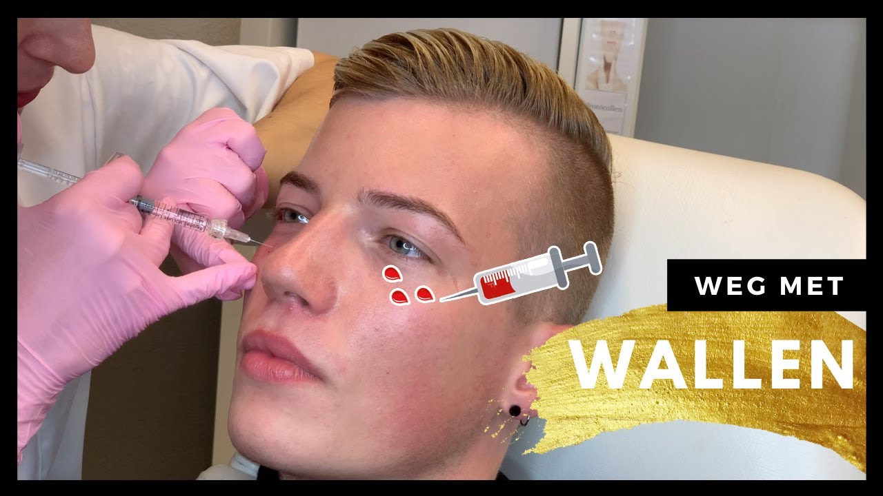 Traangoot/Donkere Wallen Behandeling | Weg Met Donkere Kringen en ...