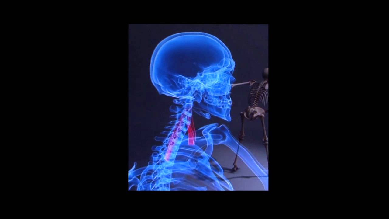 Contractura cervical/ Cervical Spine Muscle Spasm - YouTube