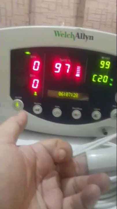 NIBP monitor - YouTube