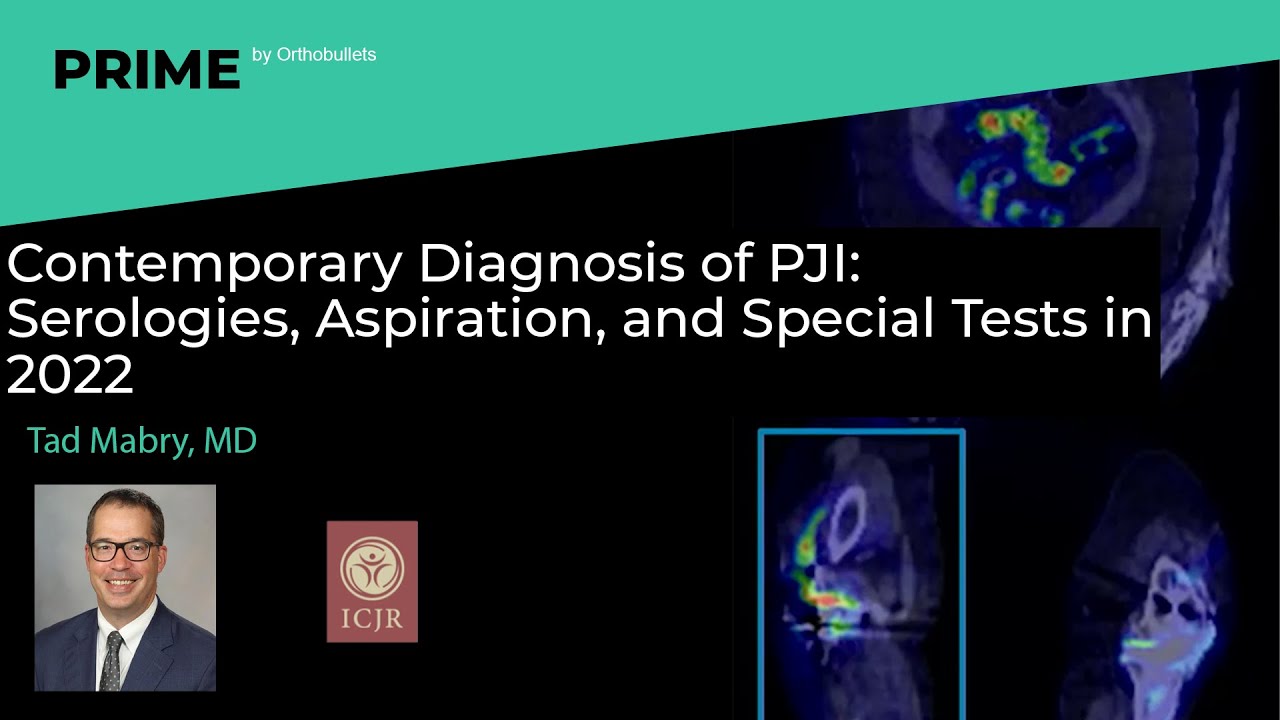 Contemporary Diagnosis of PJI Serologies, Aspiration, and Special Tests ...