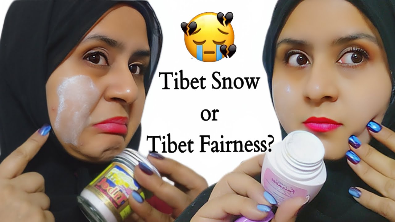 Which Tibet Cream Actually Works? Tibet Snow Vs Tibet Fairness Cream ...