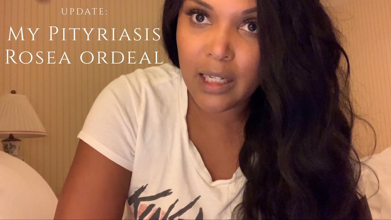 Update on My Pityriasis Rosea Ordeal - YouTube
