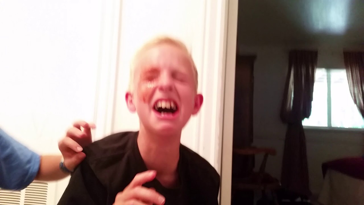 GETTING EYE SHOT OUT WITH RIVAL NERF GUN. NOT CLICKBAIT. - YouTube