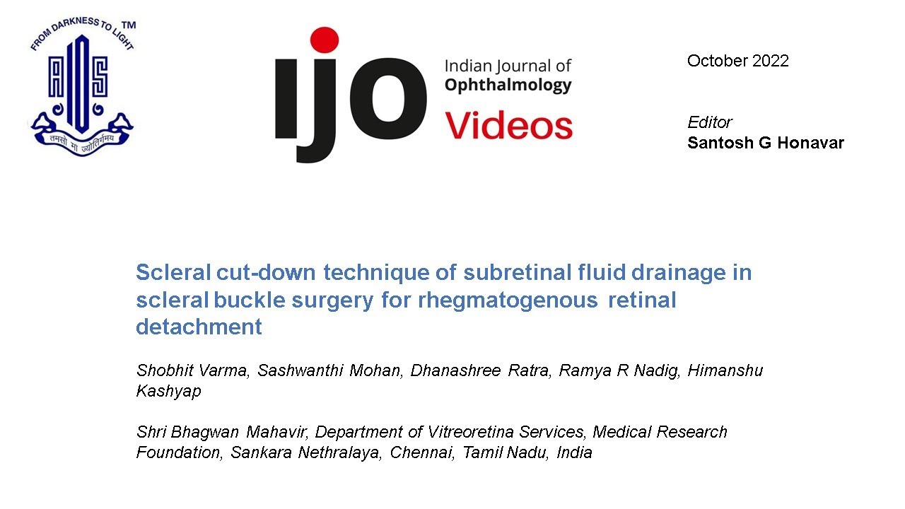 Scleral cut‑down technique of subretinal fluid drainage in scleral buc ...