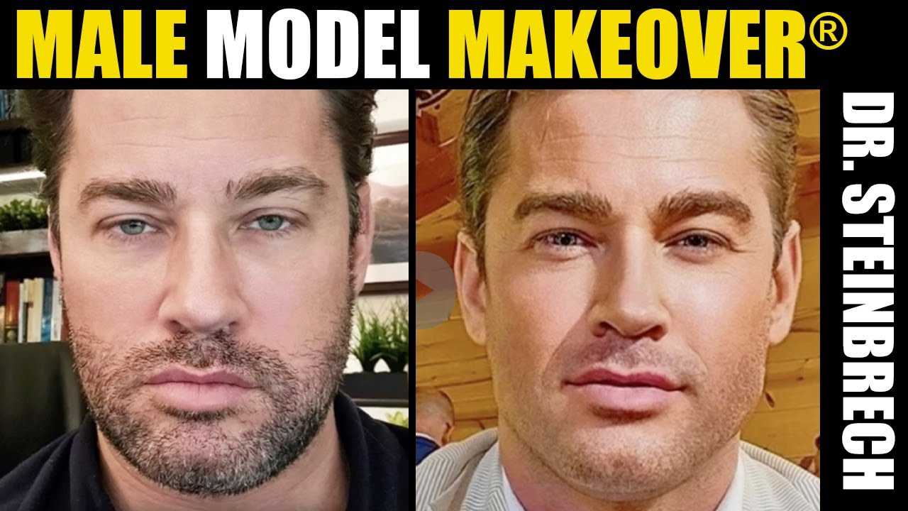 Male Model Makeover Featuring Zack | Male Plastic Surgery - YouTube