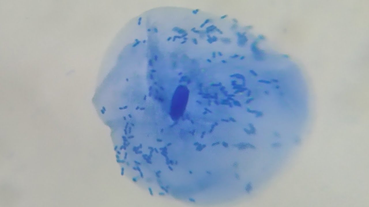 Observation microscopique de cellules buccales - YouTube