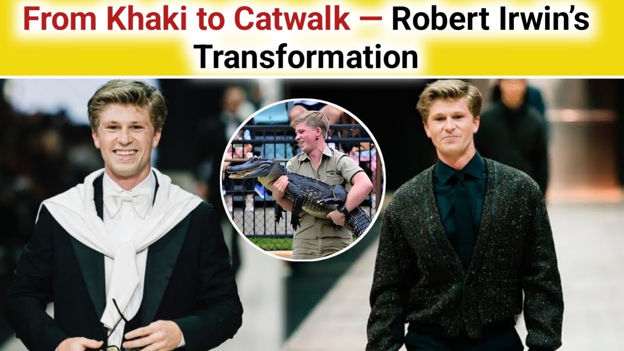 Robert Irwin's Stunning Transformation Shocks The Internet | Robert ...