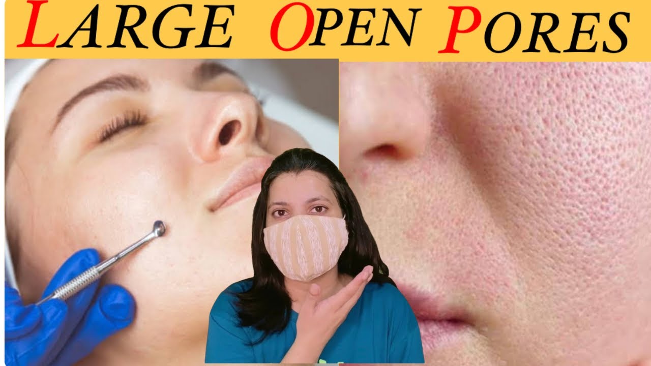how to treat open pores || Large pores & treatment 👩‍🦳 ! Asma fazal ...