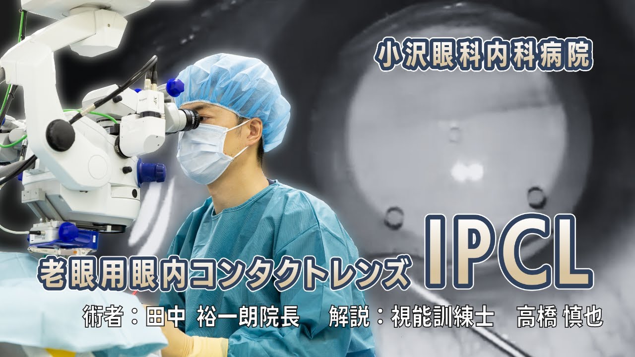 老眼用眼内コンタクトレンズ IPCL 小沢眼科内科病院 茨城県 水戸市 眼科 - YouTube
