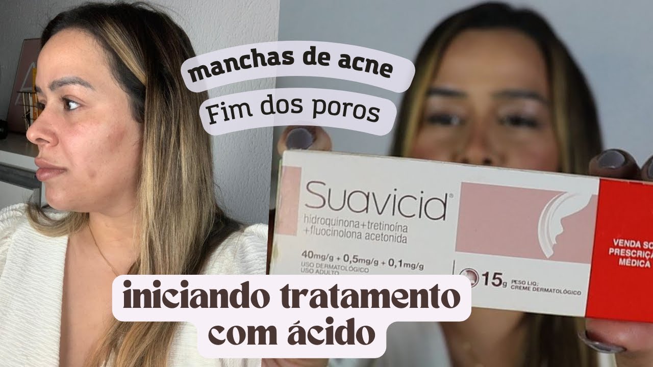 Tratando as manchas da pele novamente com Suavicid + SKincare Noturno ...