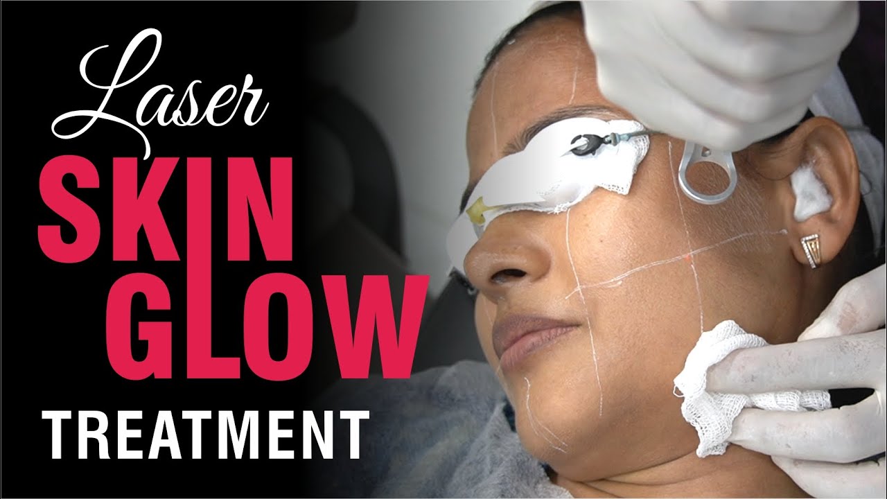 Laser skin glow treatment | Carbon laser Treatment Sakhiya Skin Clinic ...