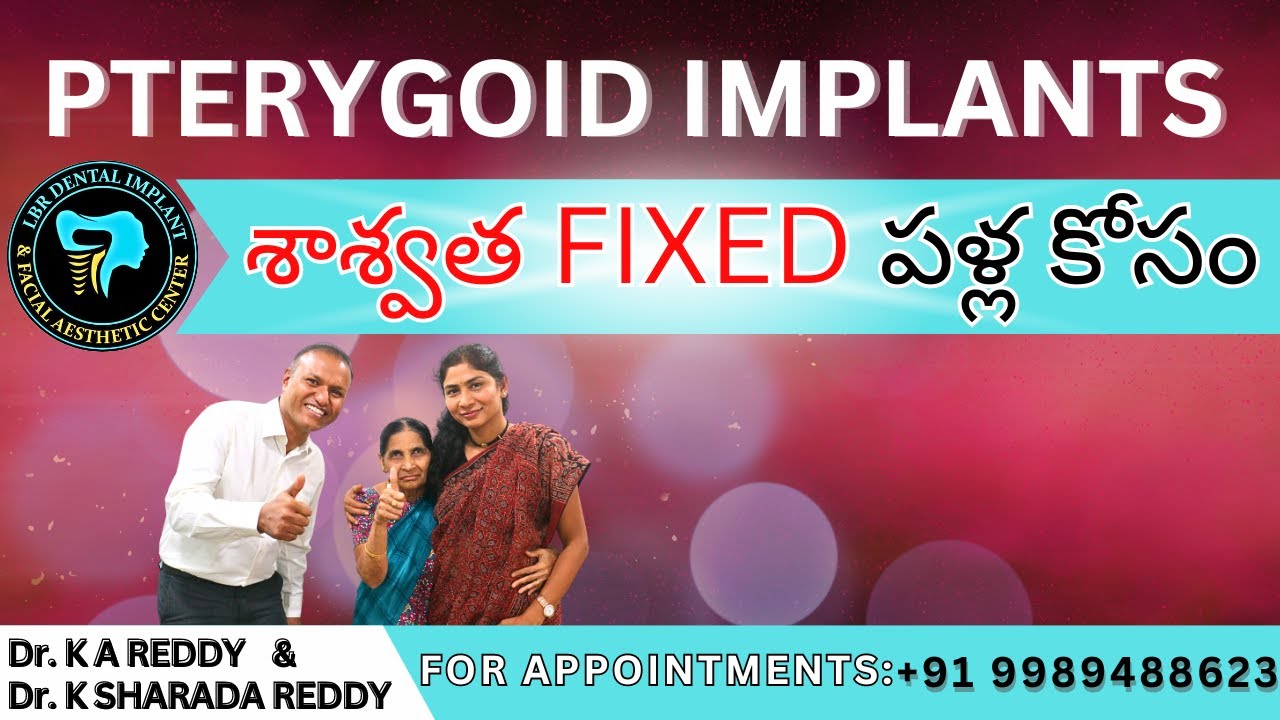 శాశ్వత పళ్ల కోసం FIXED PTERYGOID IMPLANTS ? | by Dr. K Sharada Reddy ...
