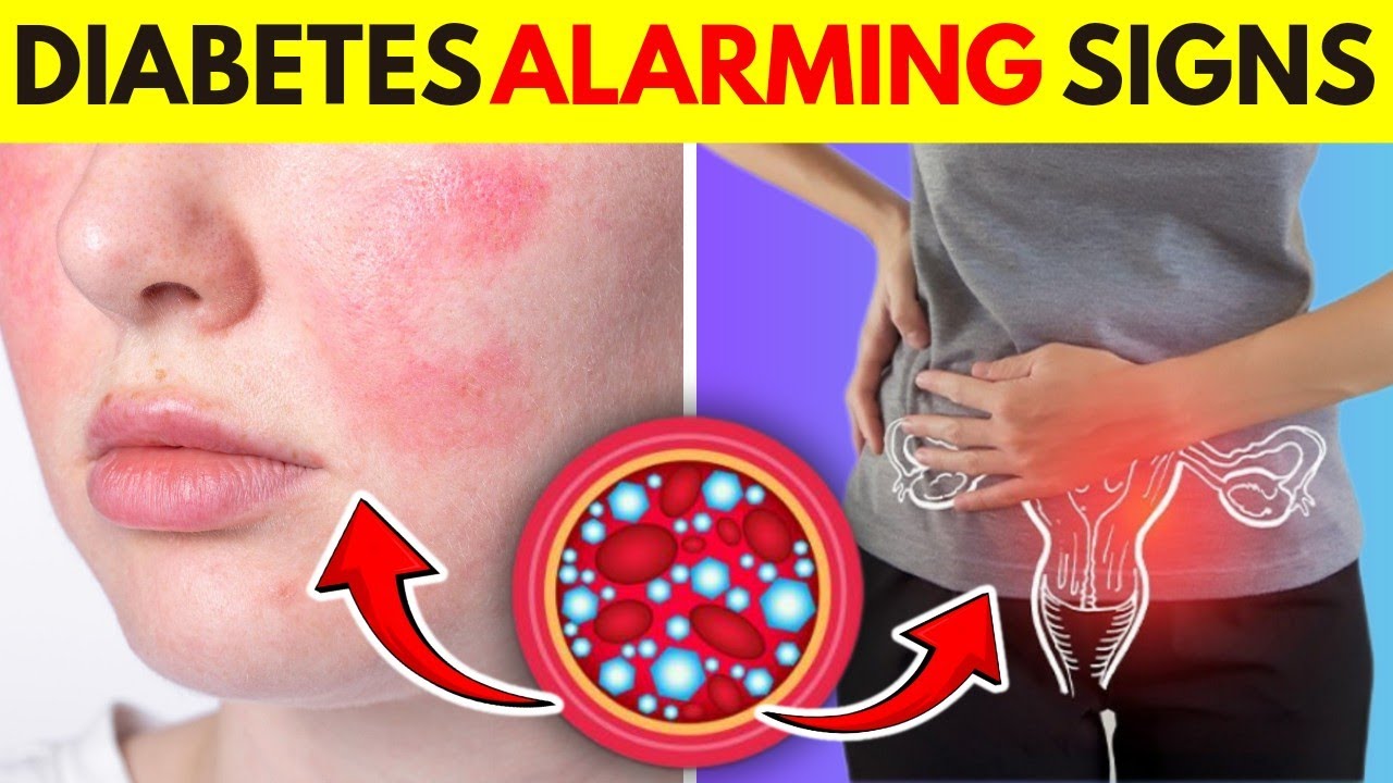 10 Alarming Signs Your Blood Sugar Is Too High YouTube 10 Alarming Signs Your Blood Sugar Is Too High YouTube
