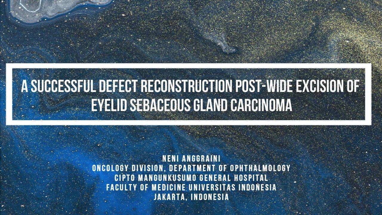 Defect Reconstruction of Eyelid Sebaceous Gland Carcinoma - YouTube