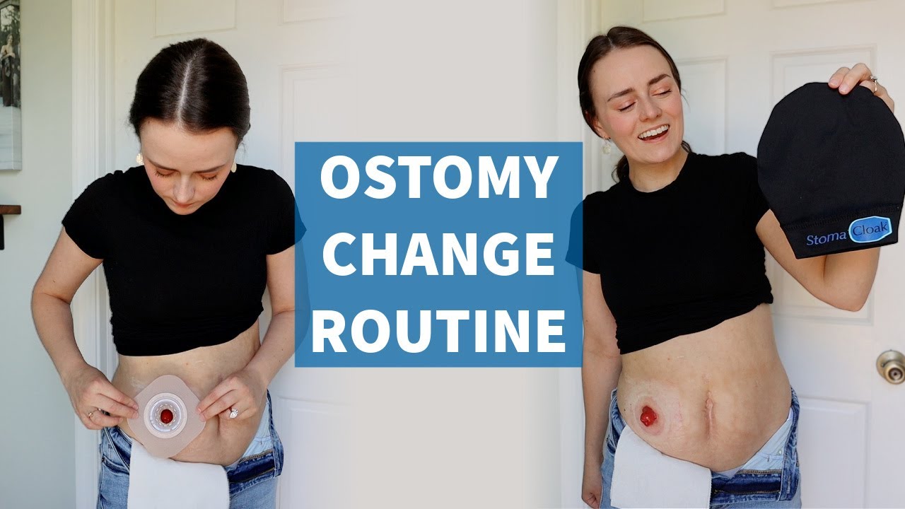 Ostomy Routines Look Different Person to Person - Here's How I Change Mine! - YouTube