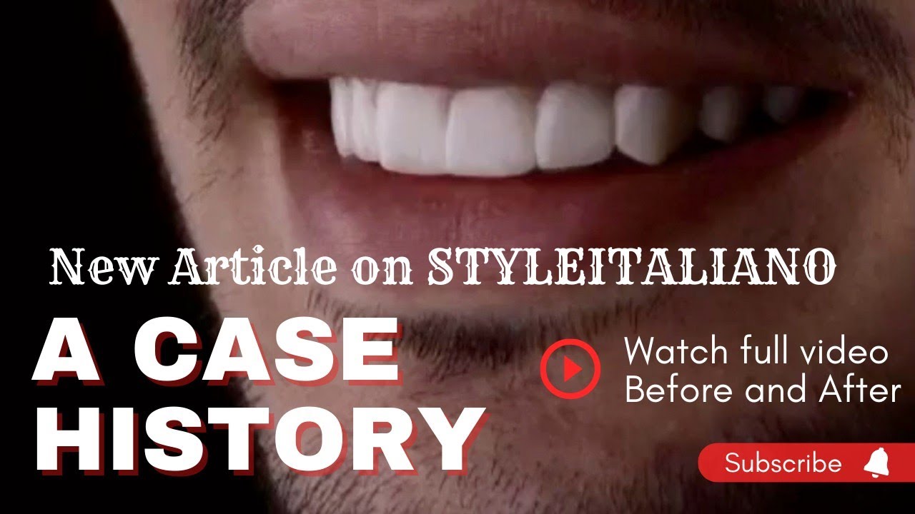 Direct Composite Restoration | STYLEITALIANO | smile makeover | smile ...