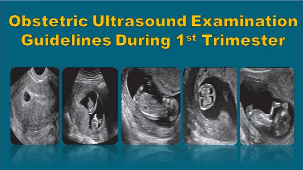 First Trimester Ultrasound || Step by Step Examination Guidelines for ...