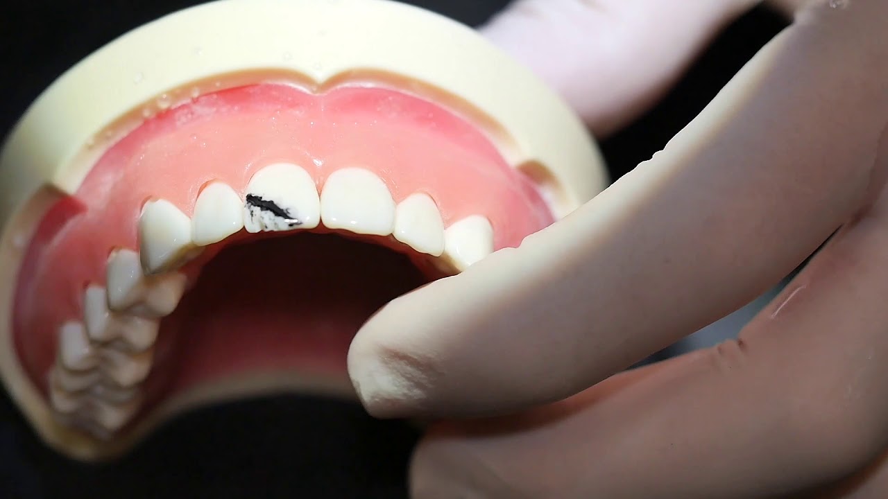 Class 4 cavity design - YouTube