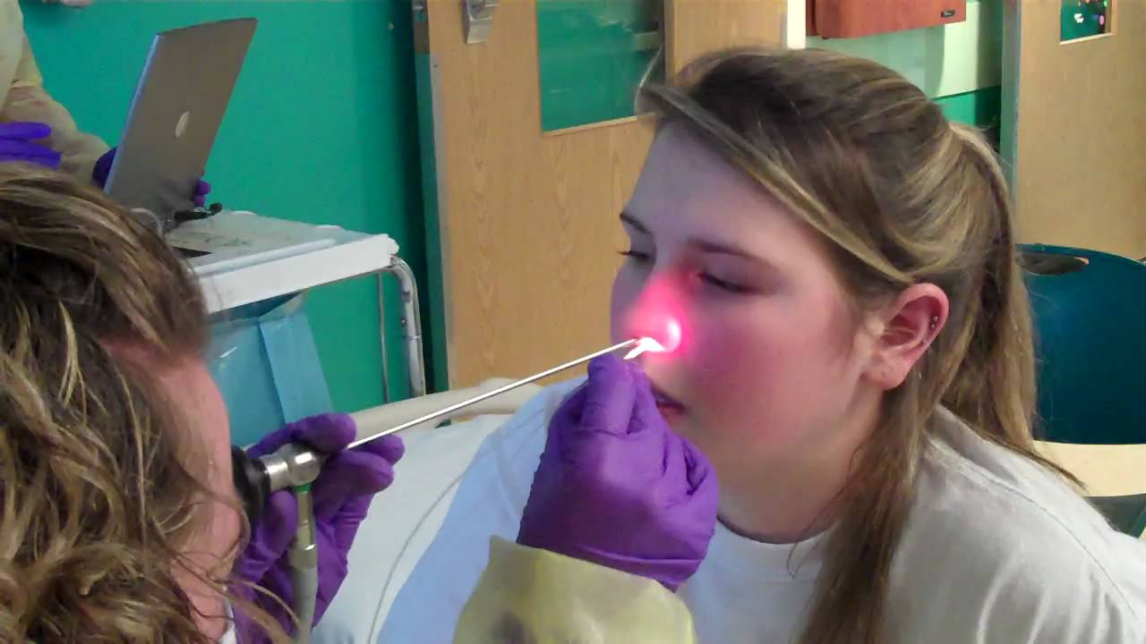 Nasal Potential Difference Measurement - YouTube
