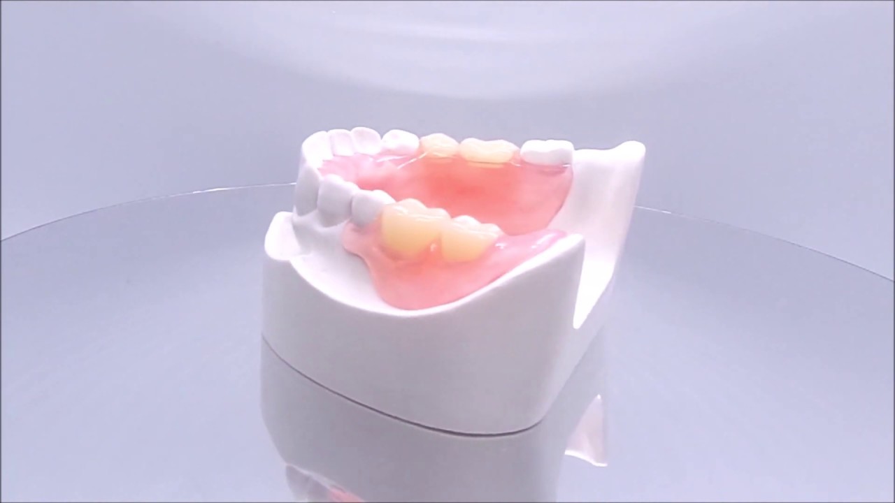 Vidéo TCS® Unbreakable™ du bas Made in Dental Connexion - YouTube