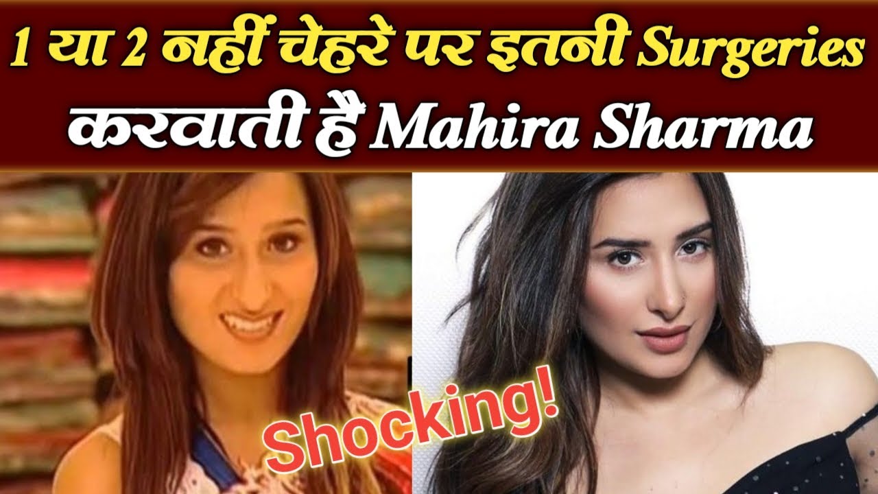 1 नहीं 2 नहीं इतनी Surgeries करवाती है BiggBoss 13 वाली Mahira | Mahira ...