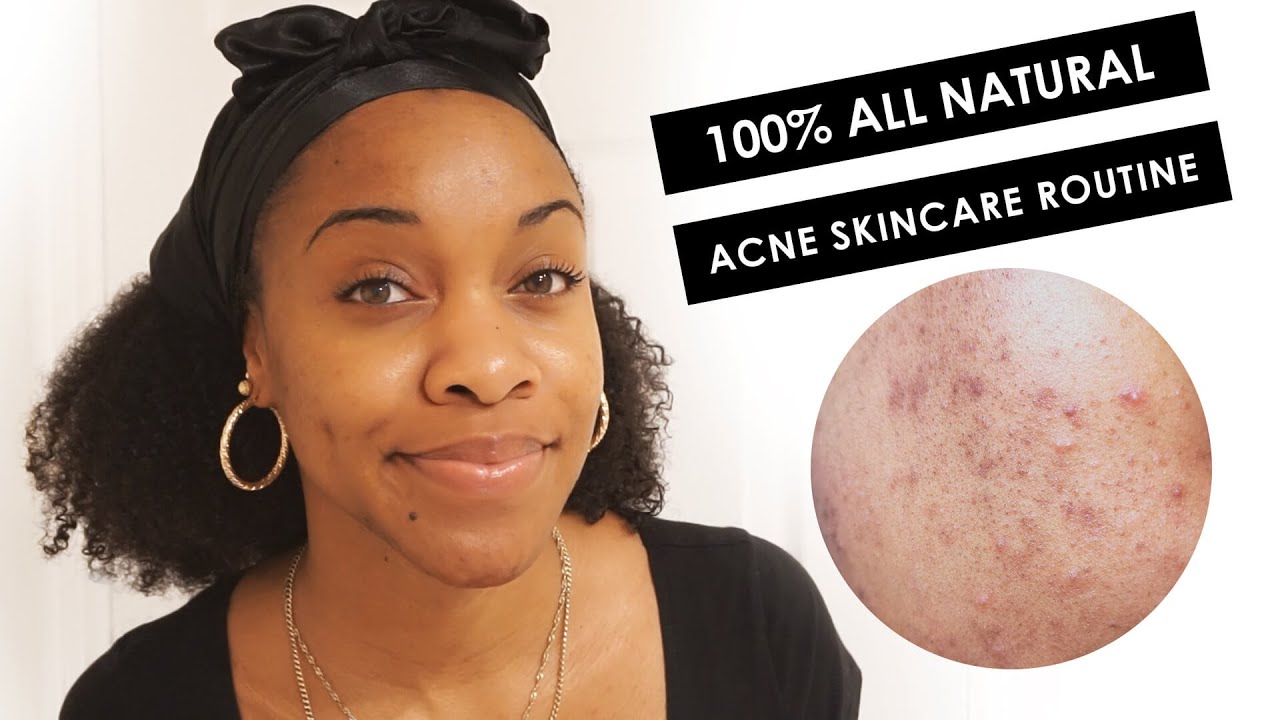 100% NATURAL ACNE SKIN CARE ROUTINE FOR SENSITIVE SKIN - YouTube