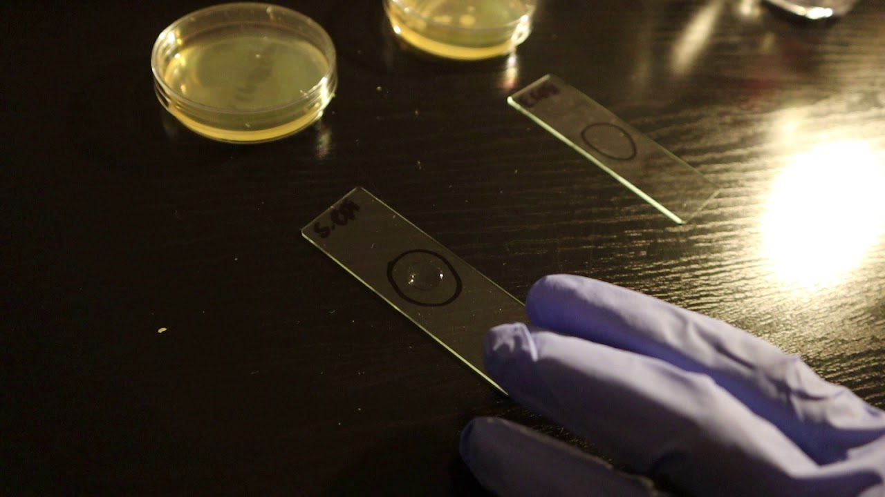 Catalase Testing - YouTube