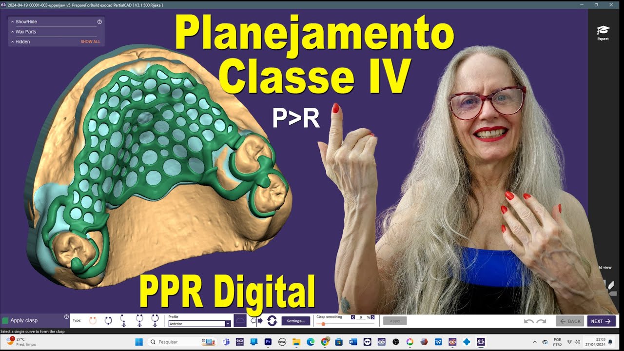 PPR DIGITAL - PLANEJAMENTO CLASSE IV - PARTIALCAD EXOCAD - CURSO PPR ...