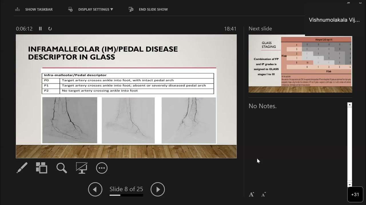 GLASS classification - YouTube