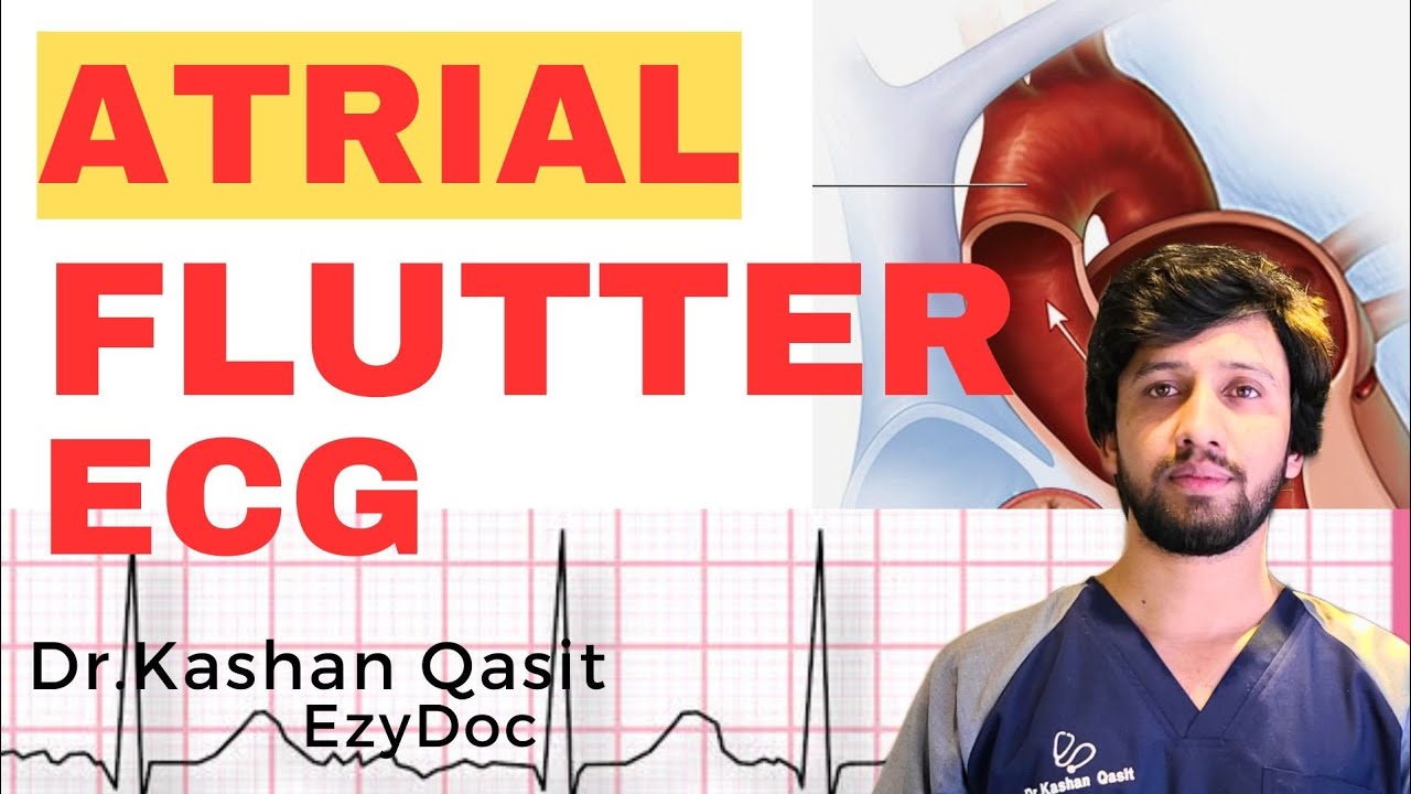 Atrial Flutter ECG Interpretation |Atrial Flutter ECG changes |Atrial ...